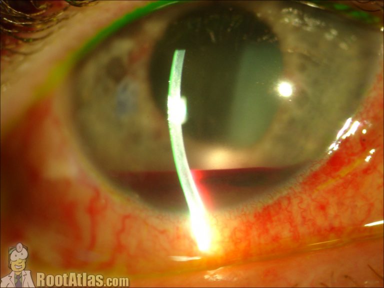 Slit Lamp - The most Important Equipment for an Eye Exam | Noel ...